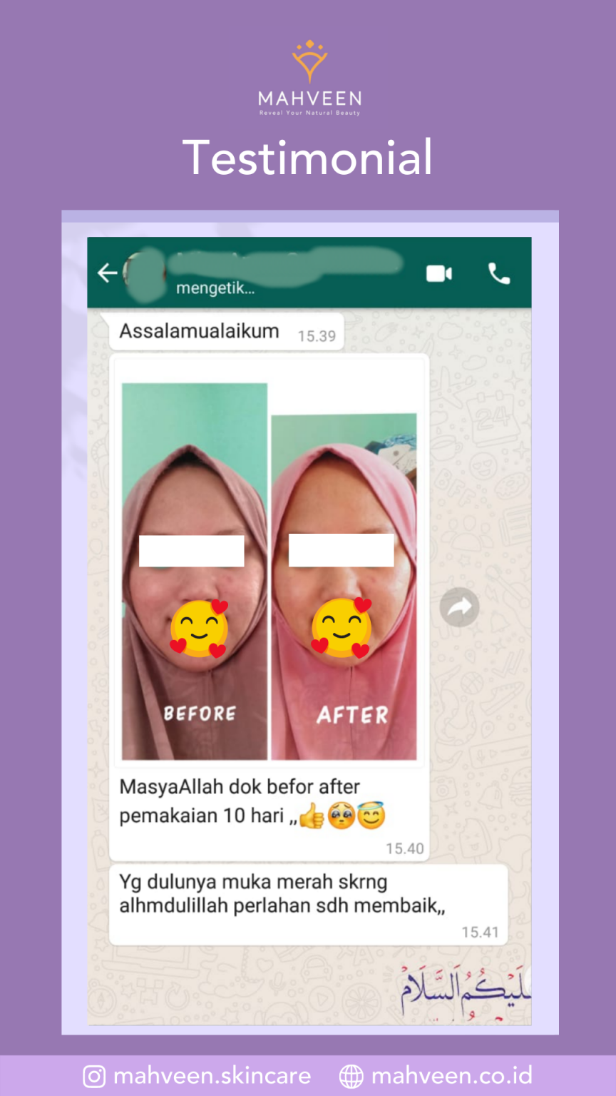 Mahveen Official Store – Mahveen Natural Skin Care