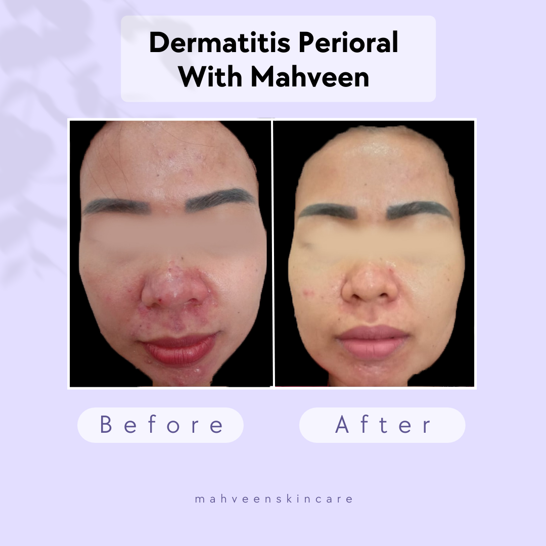 Mahveen Official Store – Mahveen Natural Skin Care